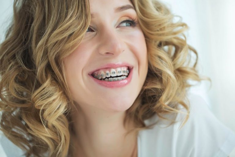 Braces in Columbus | Fast Orthodontics | Columbus Orthodontic Center